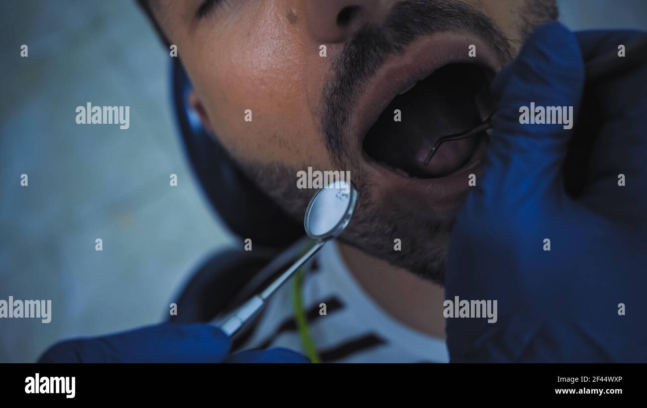 cropped view of dentist examining teeth of patient with dental ...