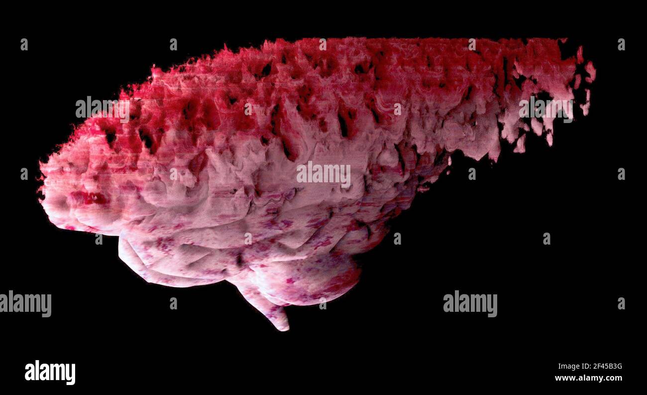 Memory lapses, forgetting things, degenerative disease. Brain problems ...