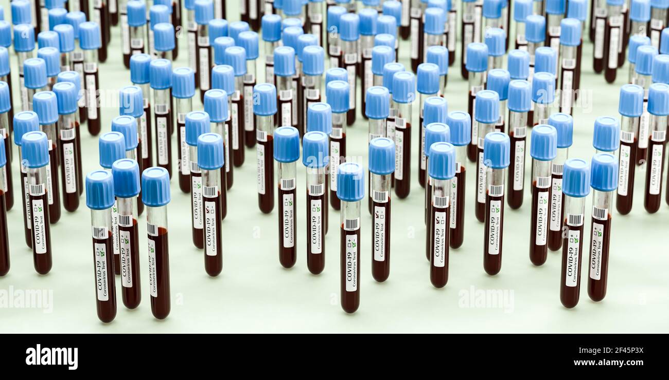 Tubes with corona virus blood samples for blood testing. Some tests in ...