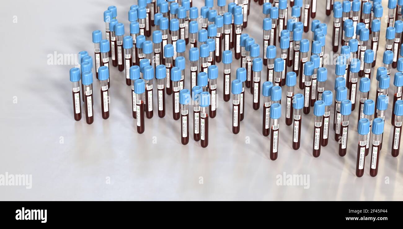 Blood sample test tube hi-res stock photography and images - Alamy