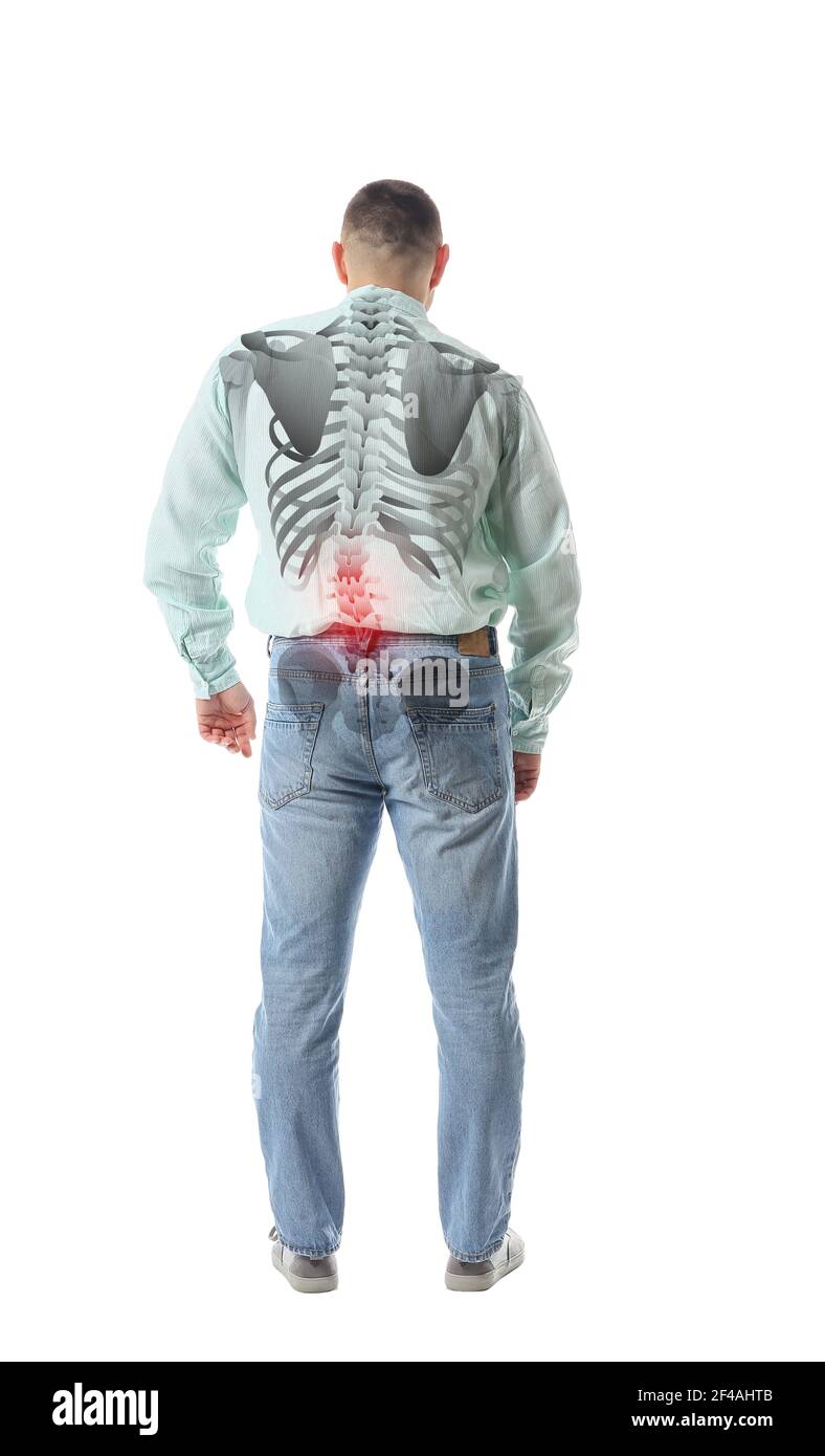 Hunchbacked hi-res stock photography and images - Alamy