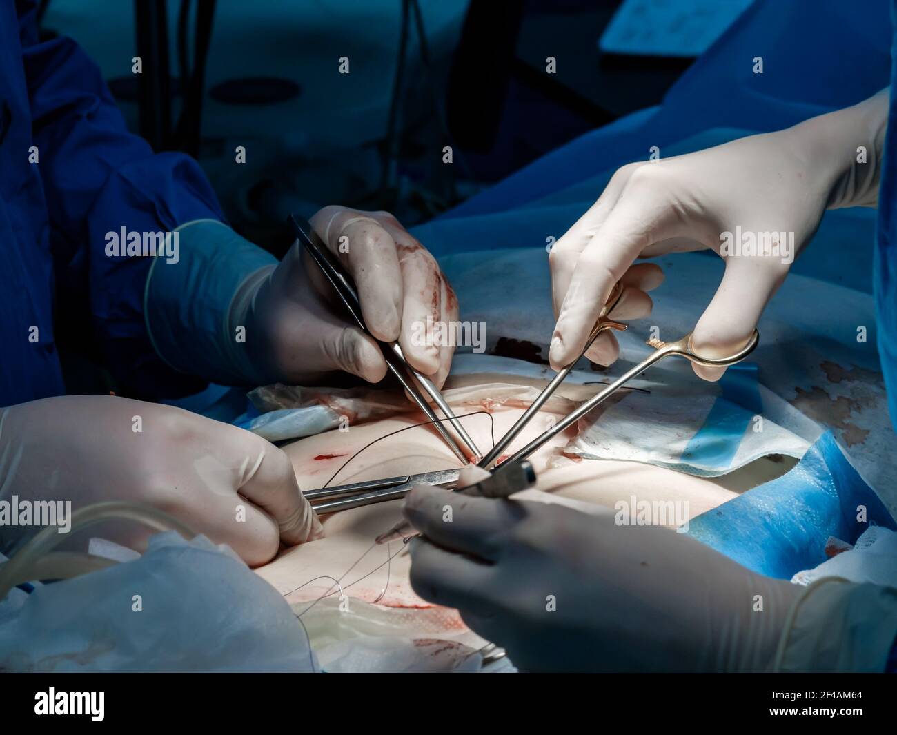 Doctors in blue uniforms use medical instruments and metal thread to ...