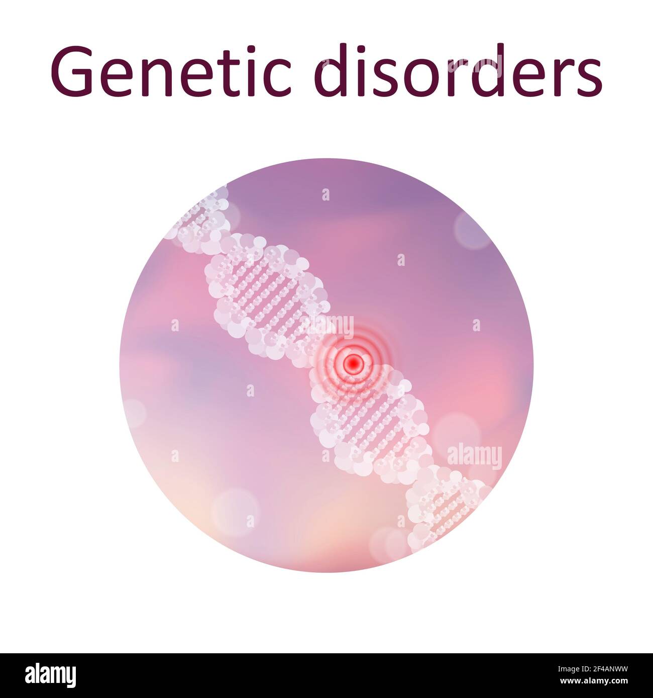 Genetic disorders, illustration Stock Photo - Alamy