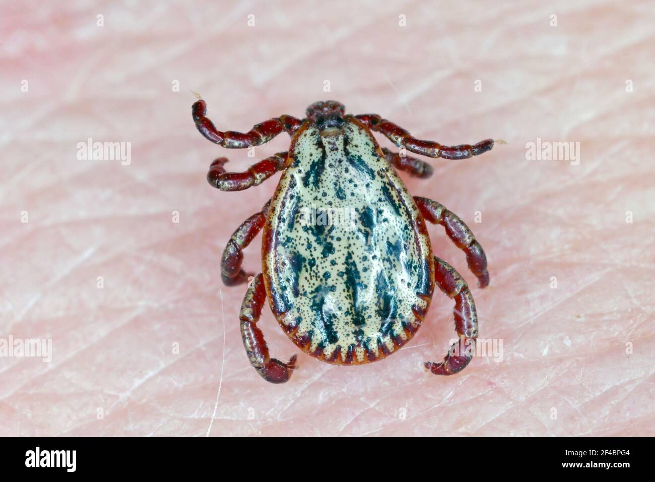 Tick walking on human skin. High magnification Stock Photo - Alamy