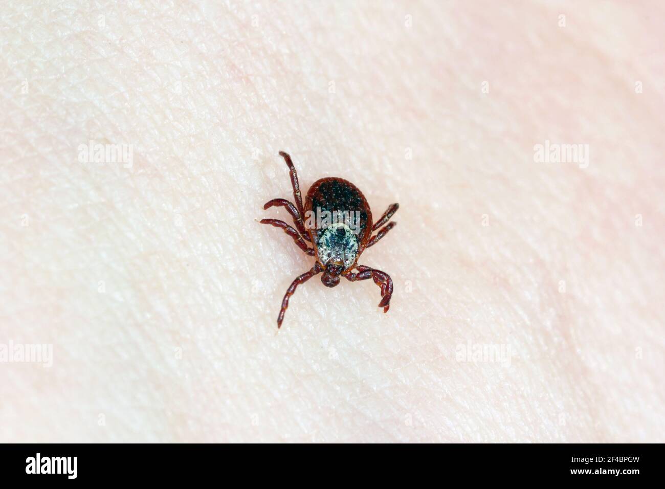 Tick infestation hi-res stock photography and images - Alamy