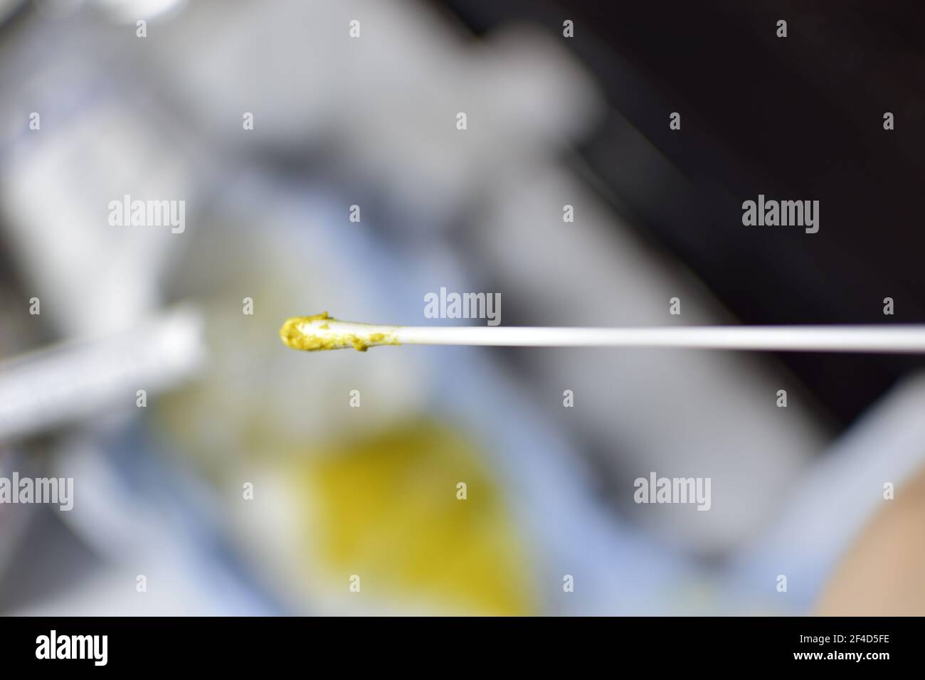 Rotavirus test for babies. Taking a poop sample for examination. Pooped ...