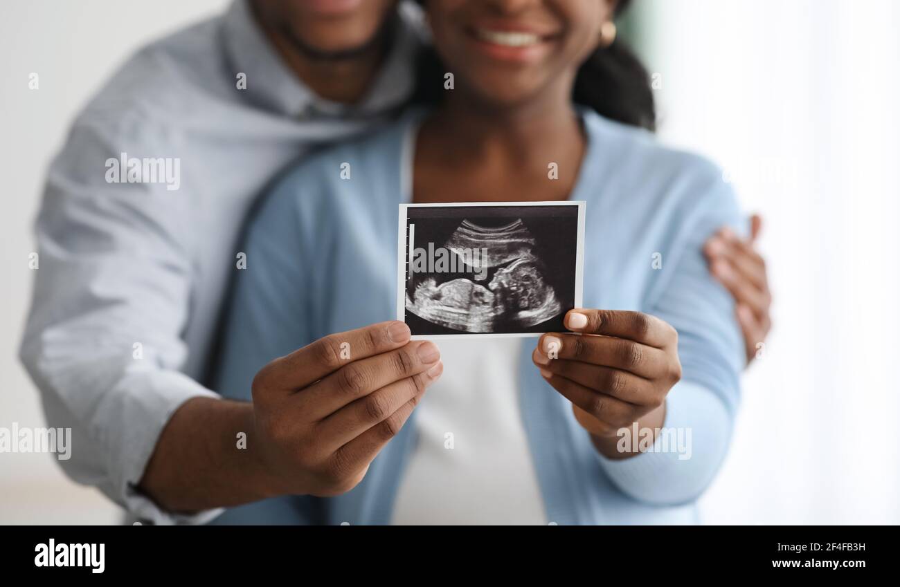 Closeup of baby sonogram in black couple hands Stock Photo - Alamy
