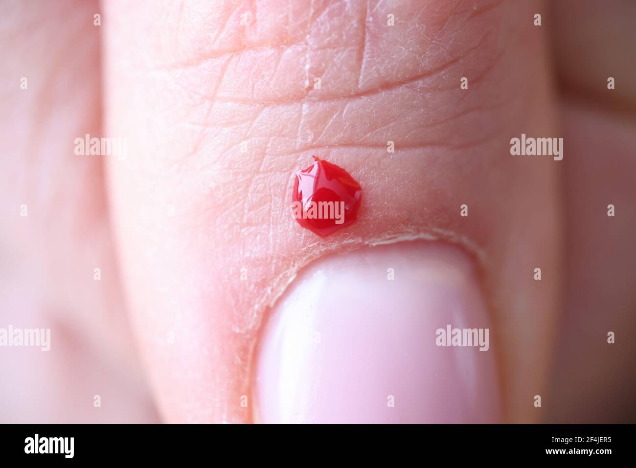Puncture wound hi-res stock photography and images - Alamy