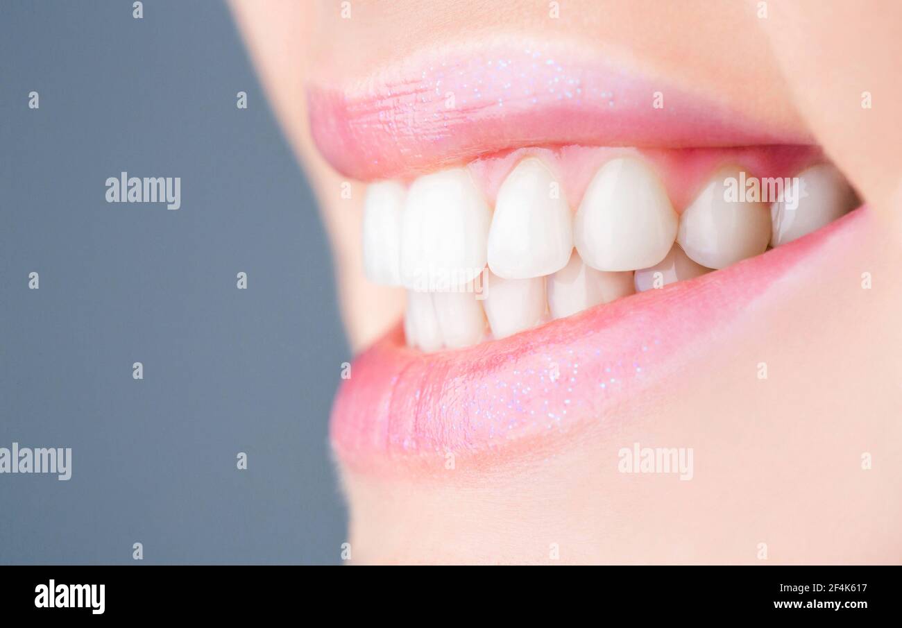 Denti Perfetti Ortodonzia Apparecchio Fisso E Invisibile Denti