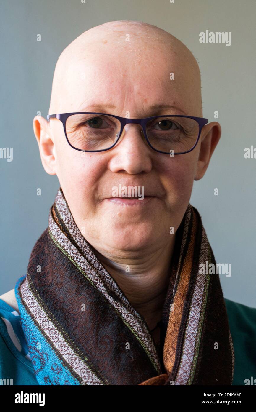 Aec syndroom hi-res stock photography and images - Alamy