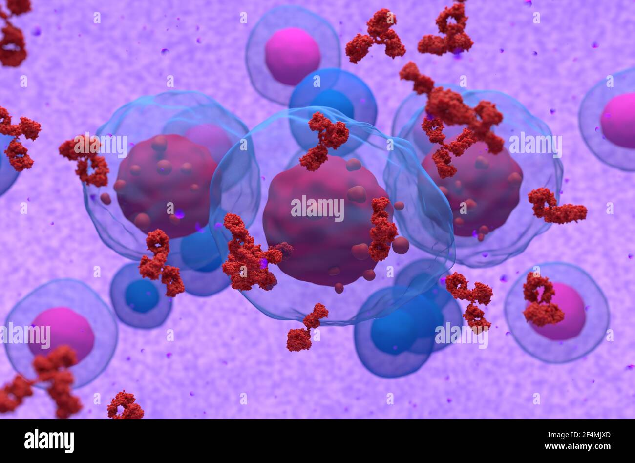 Abnormal plasma cell or b-cell in multiple myeloma emitting paraprotein ...
