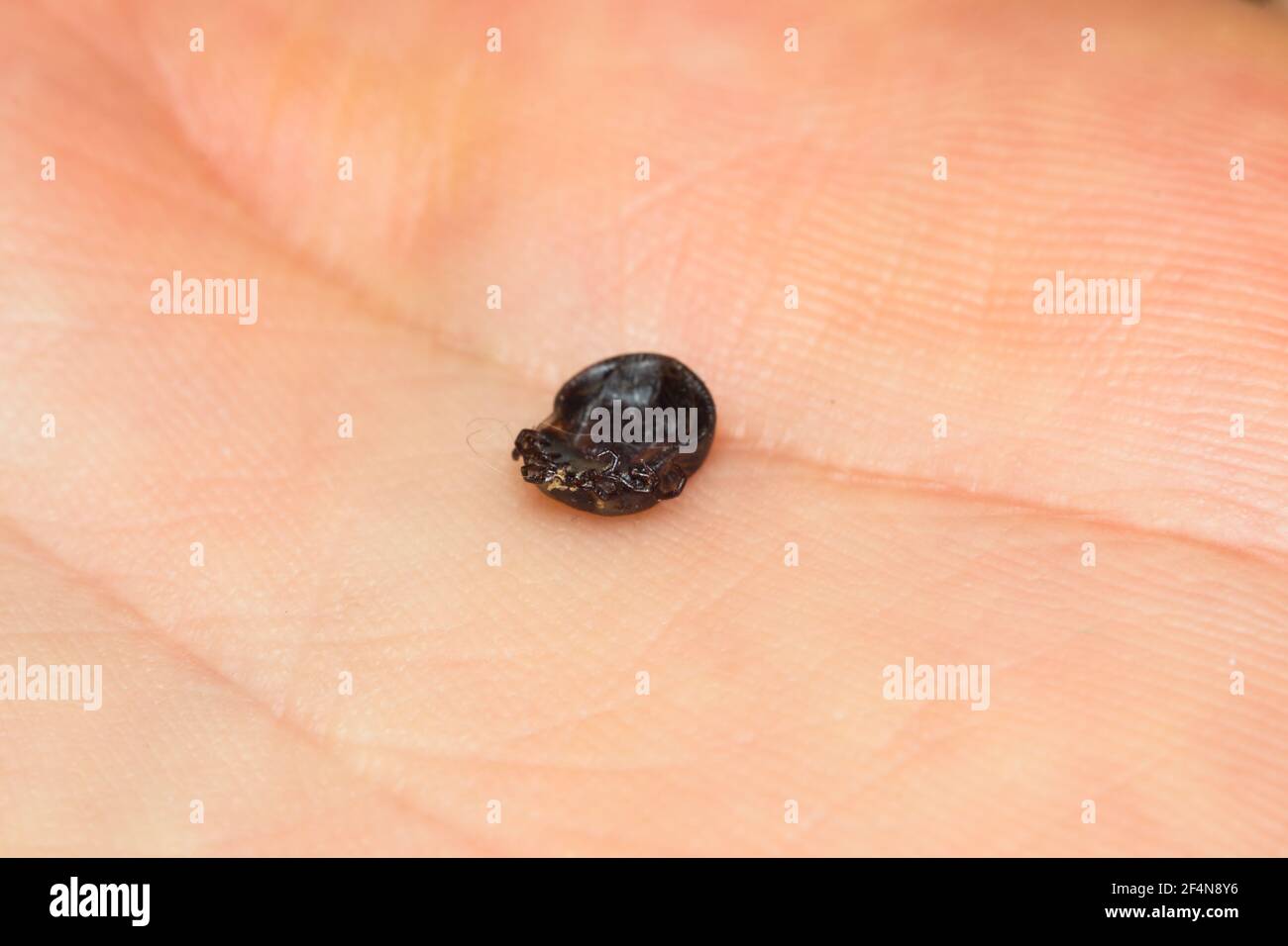 close-up photo of a dry tick on human hand Stock Photo - Alamy