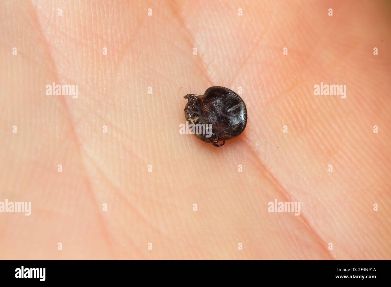 Human parasites hi-res stock photography and images - Alamy