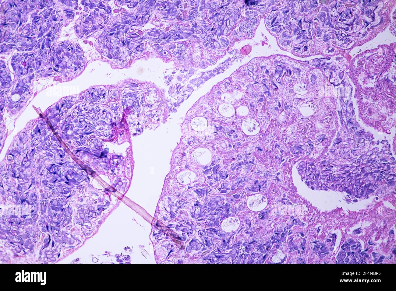 monocystis in situ transverse section under a light microscope Stock ...