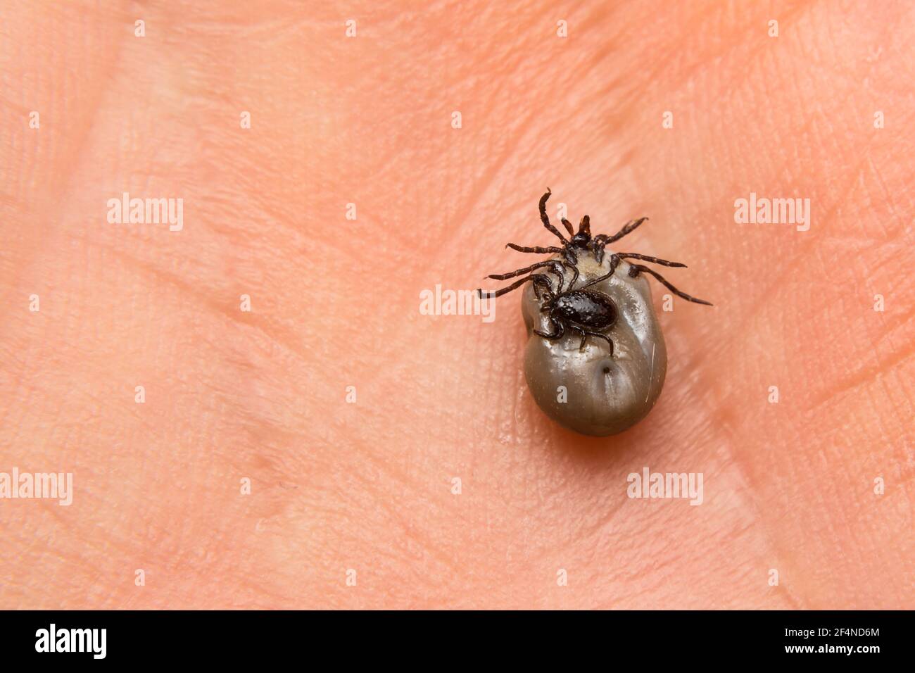 close-up photo of a tick couple male and female on human skin Stock ...