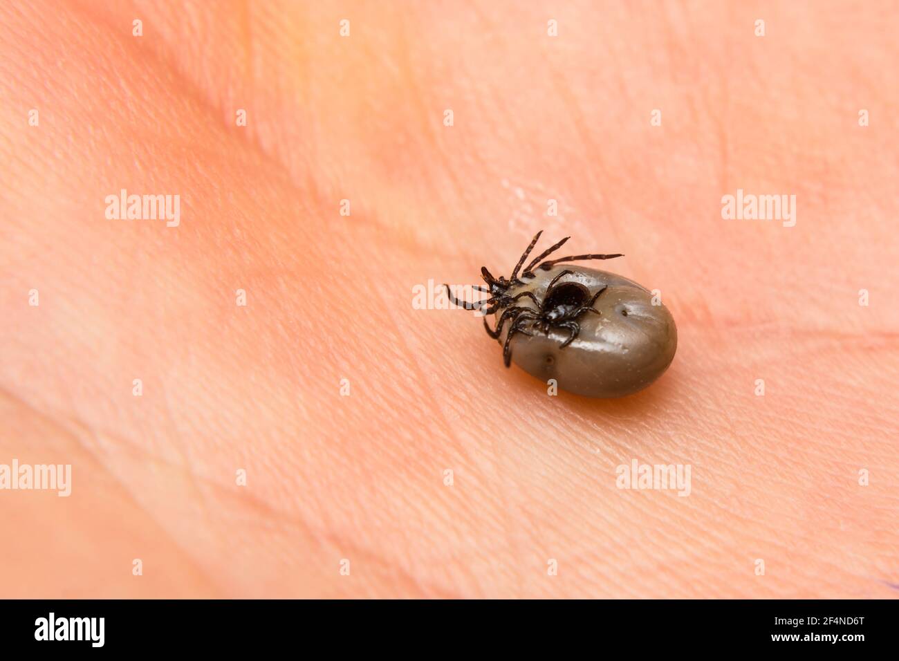 close-up photo of a tick couple male and female on human skin Stock ...