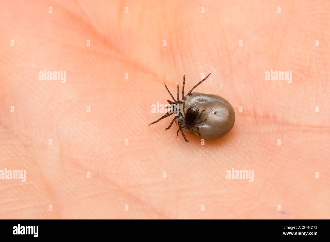 close-up photo of a tick couple male and female on human skin Stock ...