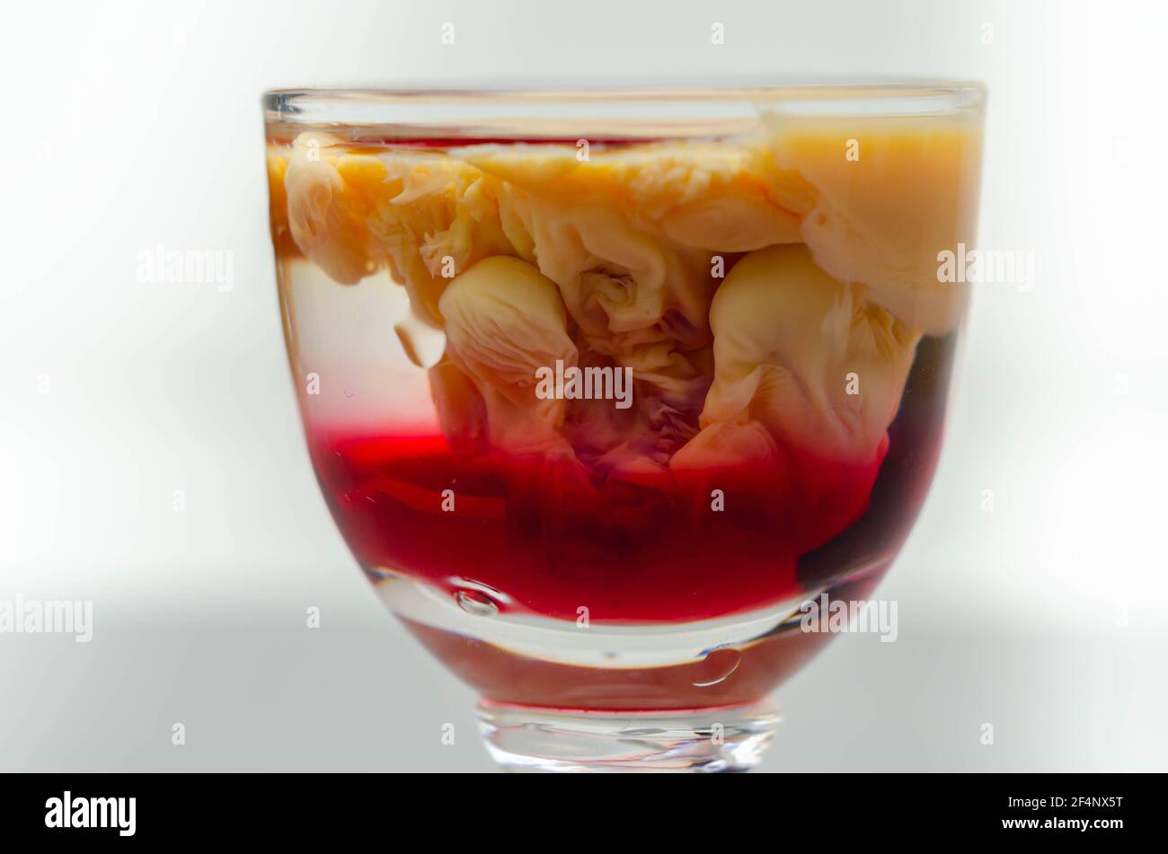Tumor Brain Cocktail