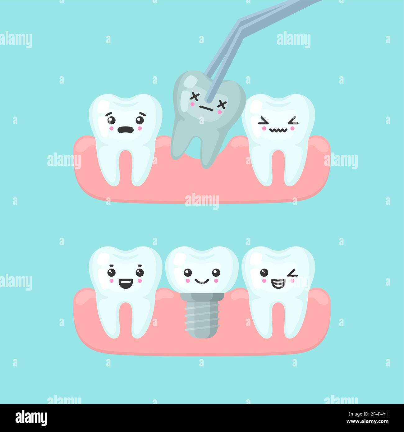 Tooth extraction hi-res stock photography and images - Alamy