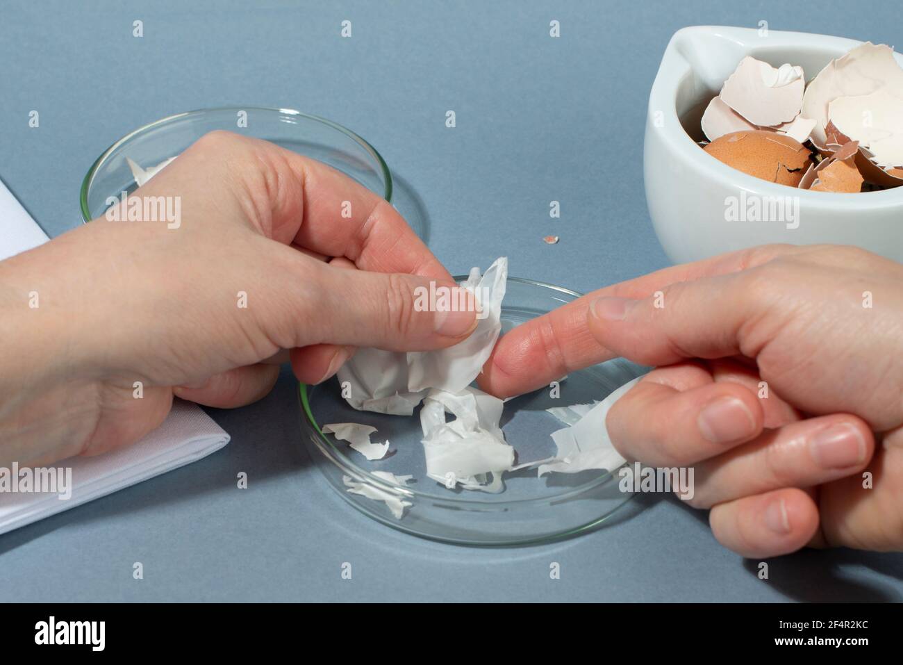 Treating Finger Injuries with eggshell membrane - alternative natural ...