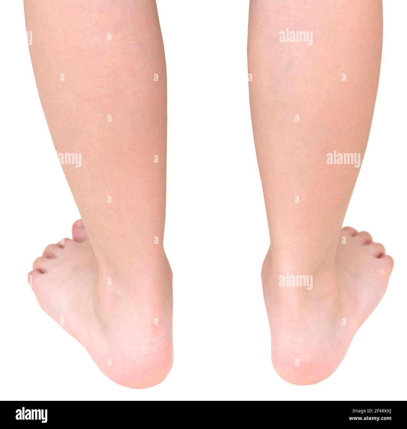 Child legs isolated on white background Stock Photo - Alamy