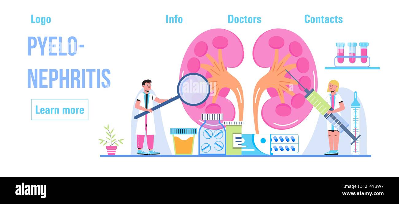 Urarthritis, ureteroscopy concept vector for medical website. Urologist ...
