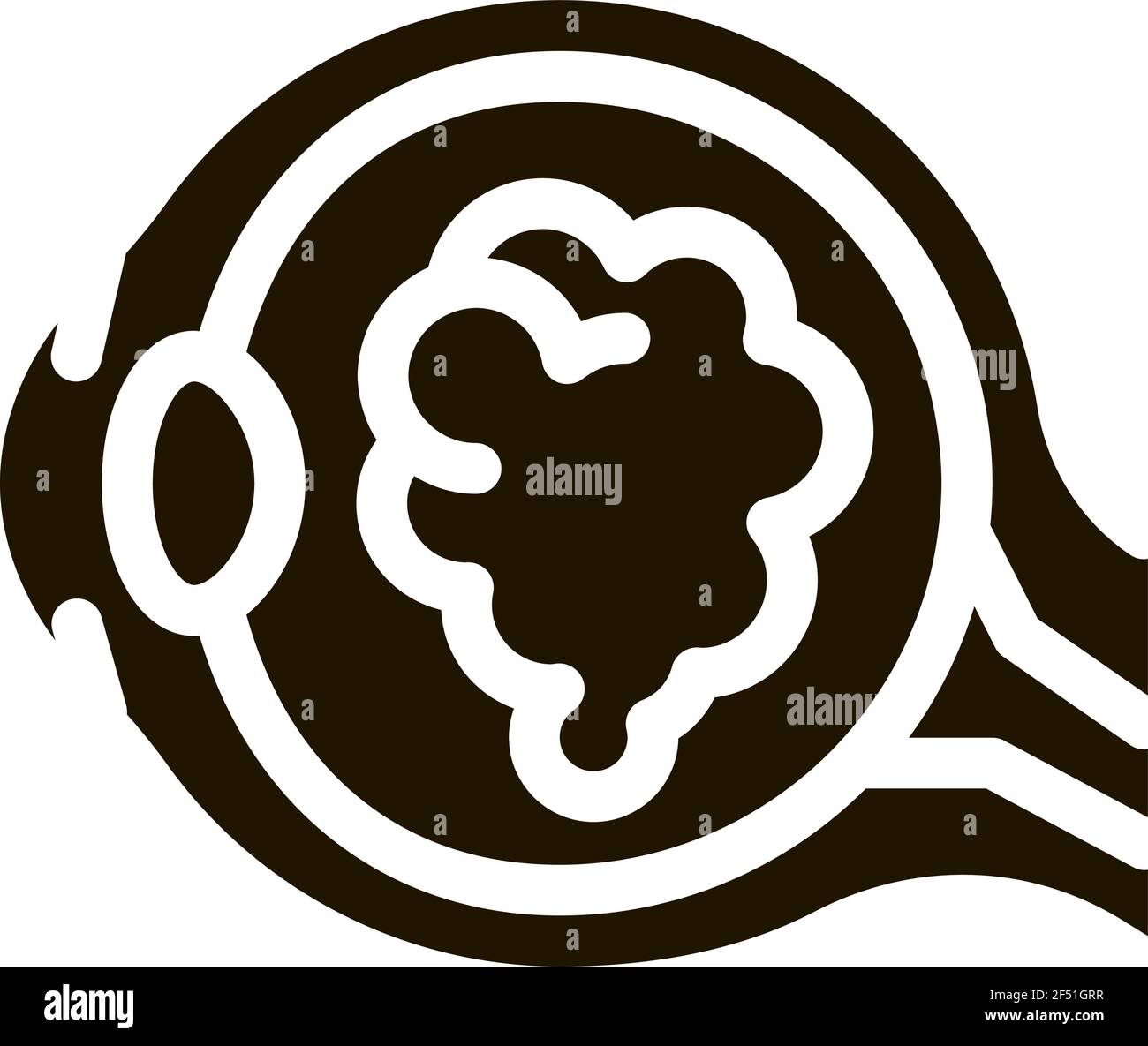 Cataract research Stock Vector Images - Alamy