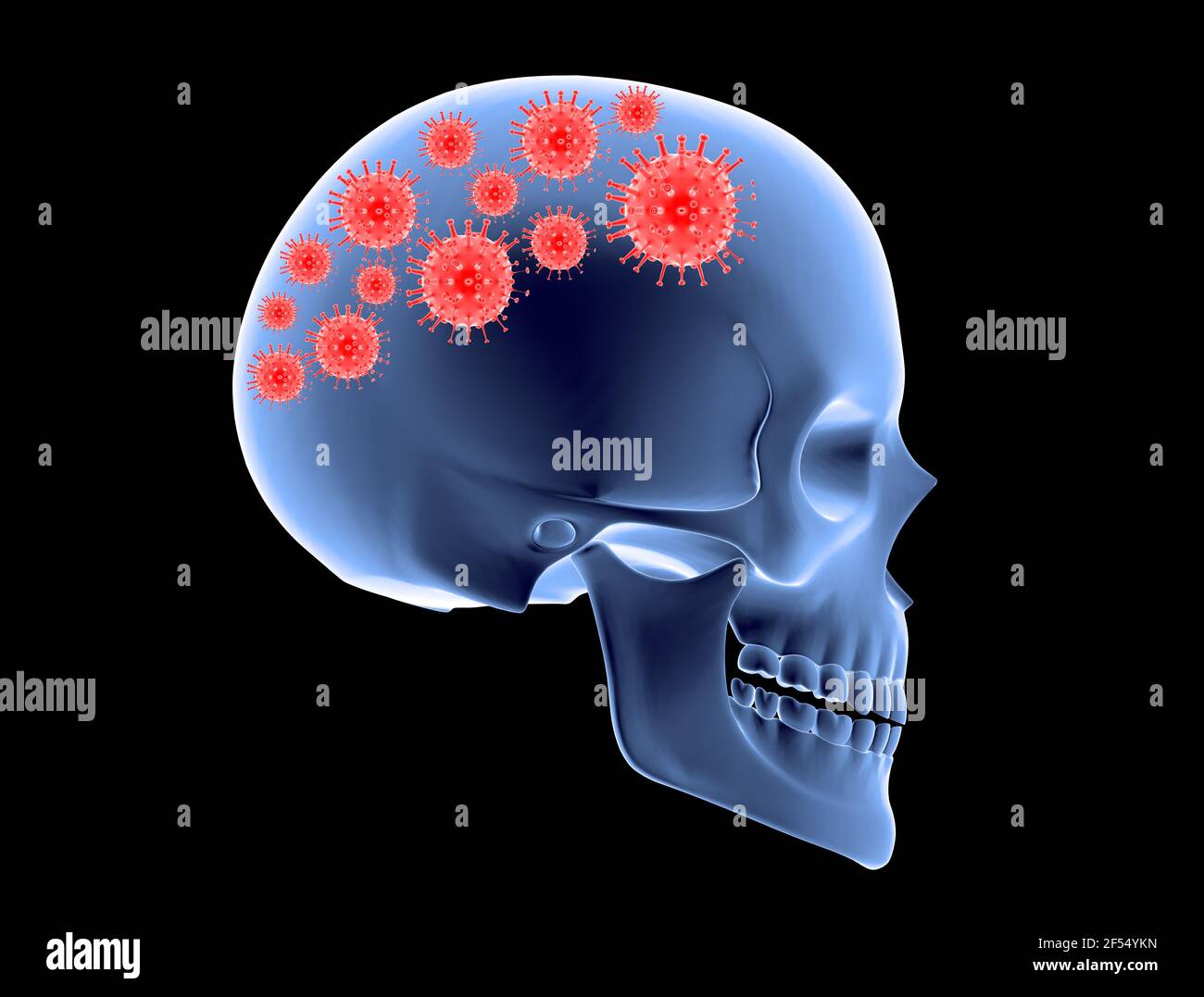 X-ray of a skull with COVID-19 instead of the brain, isolated on a ...