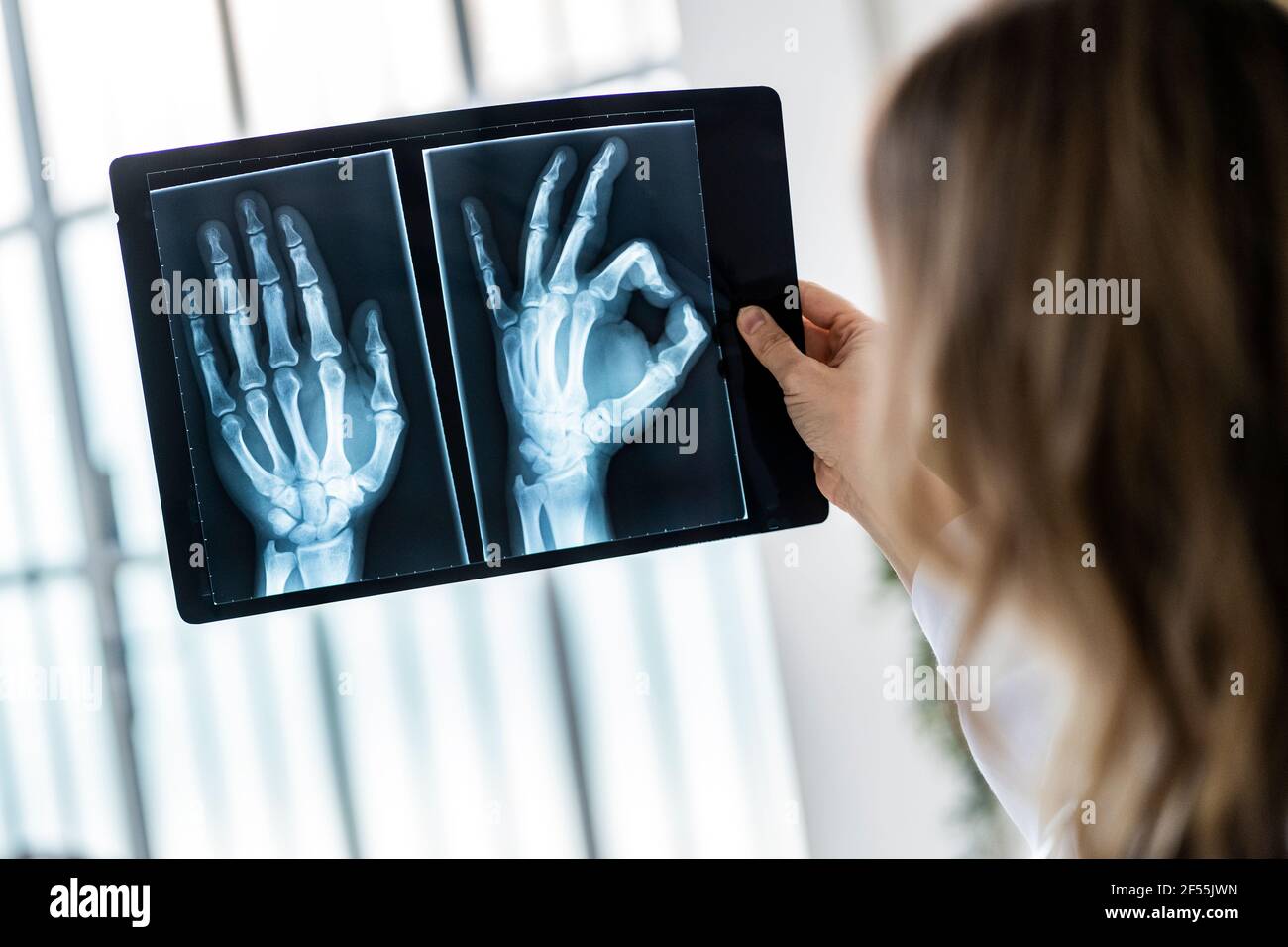 Female doctor examining X-ray of hand at medical clinic Stock Photo - Alamy