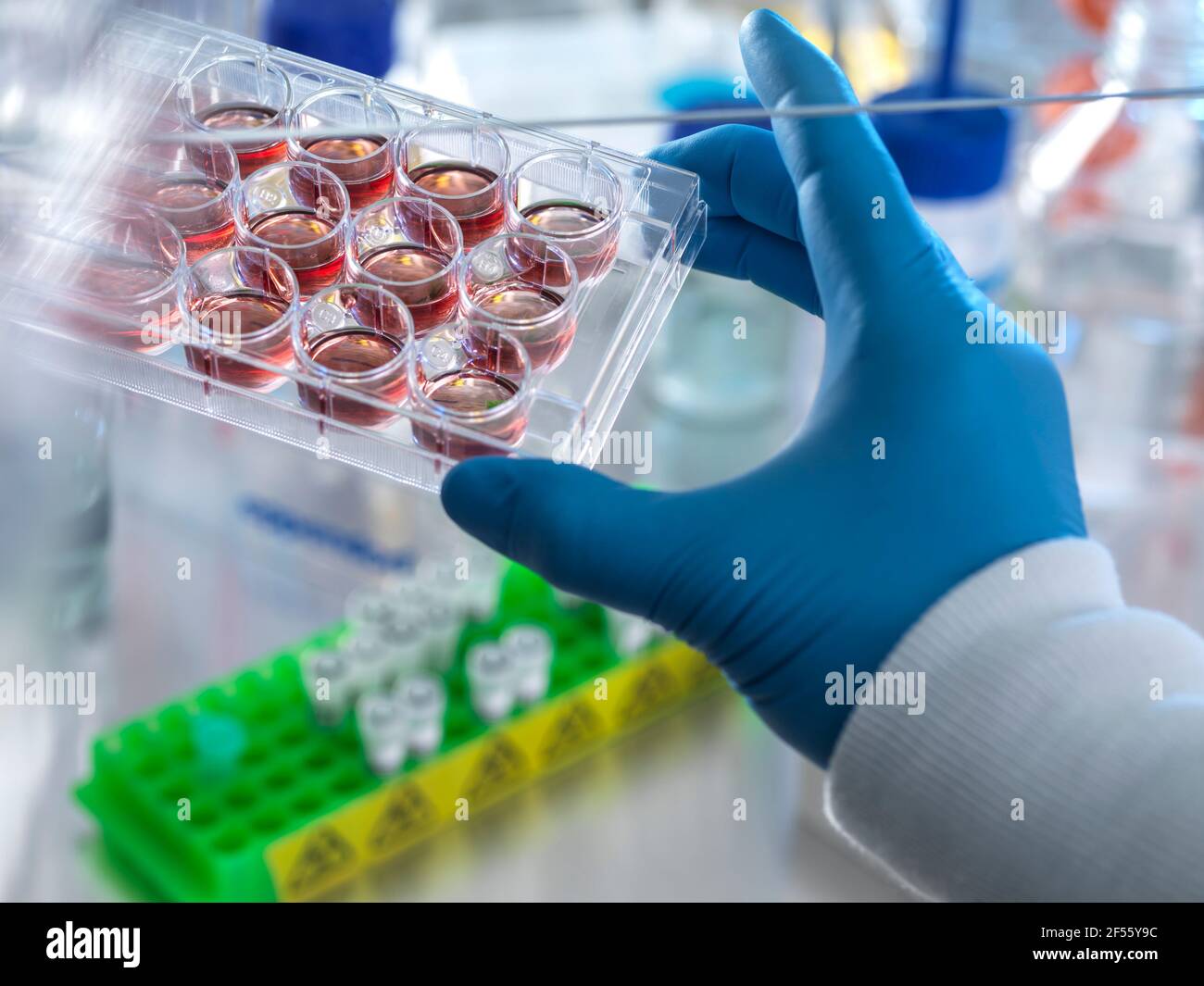 Technician holding multi well plate with blood samples in laboratory ...