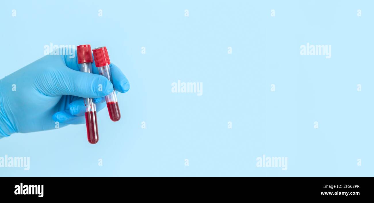 Researcher holding red blood sample flasks in laboratory. Banner with ...