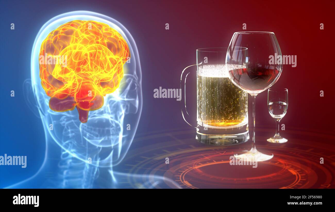 brain stricken by beer and alcohol, cg medical 3d illustration Stock ...