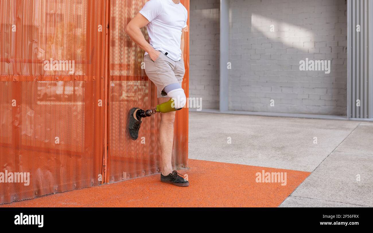 Amputated hands hi-res stock photography and images - Alamy