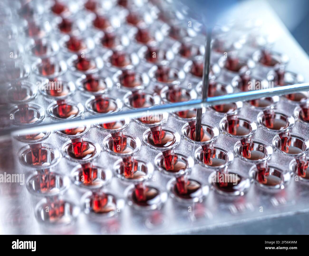 Blood samples in container at lab Stock Photo - Alamy