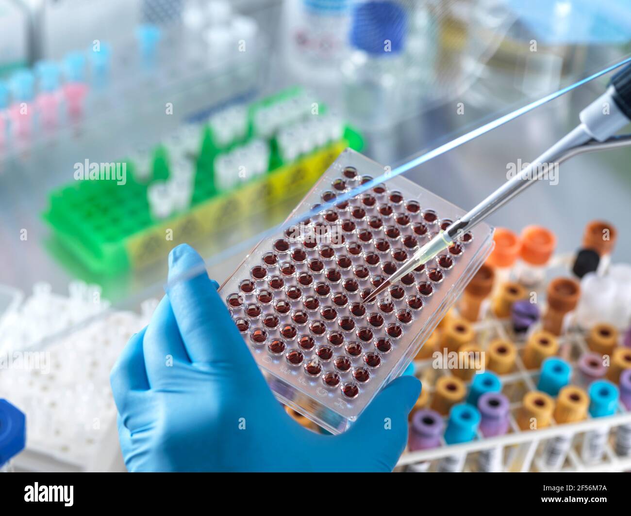 Scientist pipetting blood sample in microplate at laboratory Stock ...