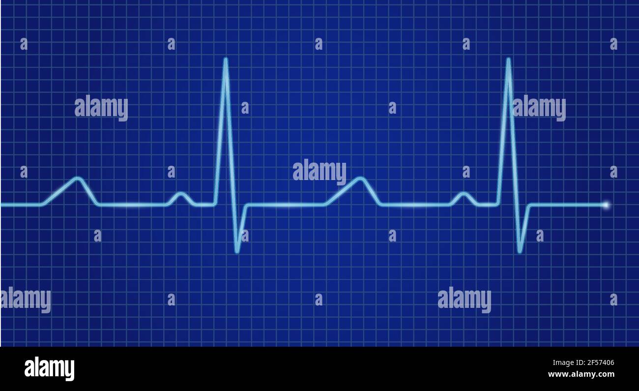 Cardiogram cardiograph oscilloscope blue screen. Heartbeat line. Vector ...
