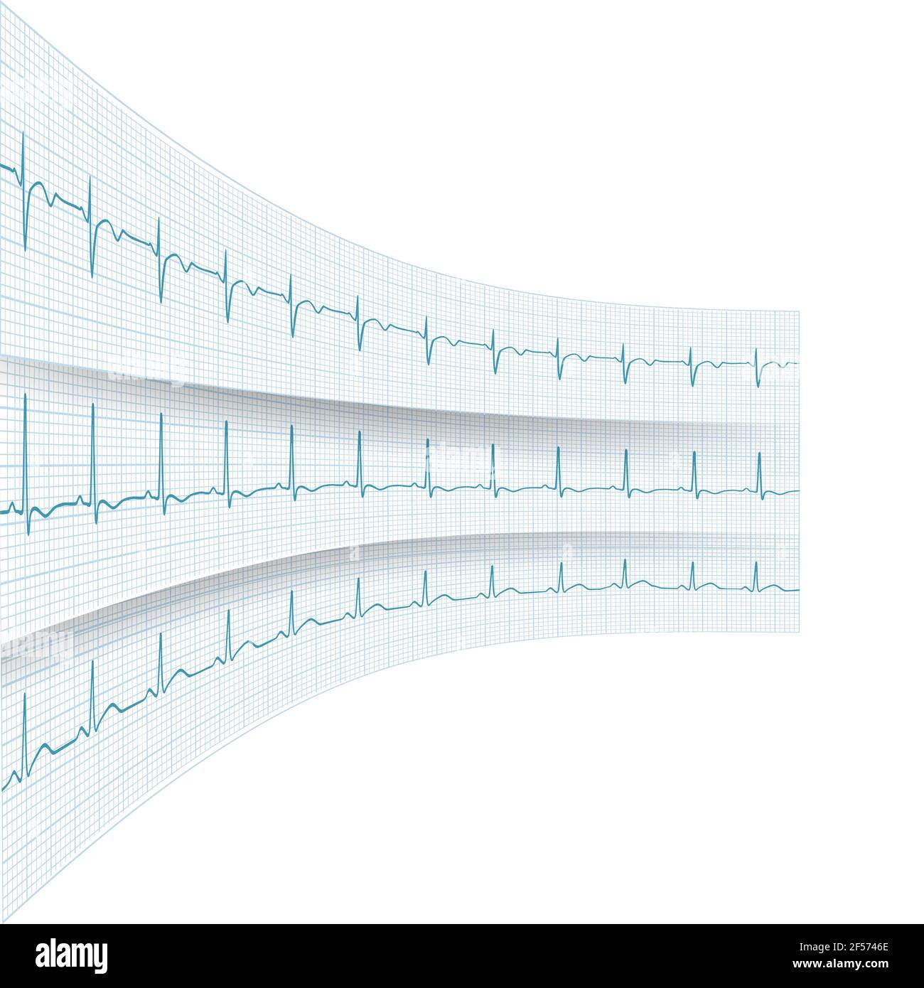 Ecg tracing hi-res stock photography and images - Alamy