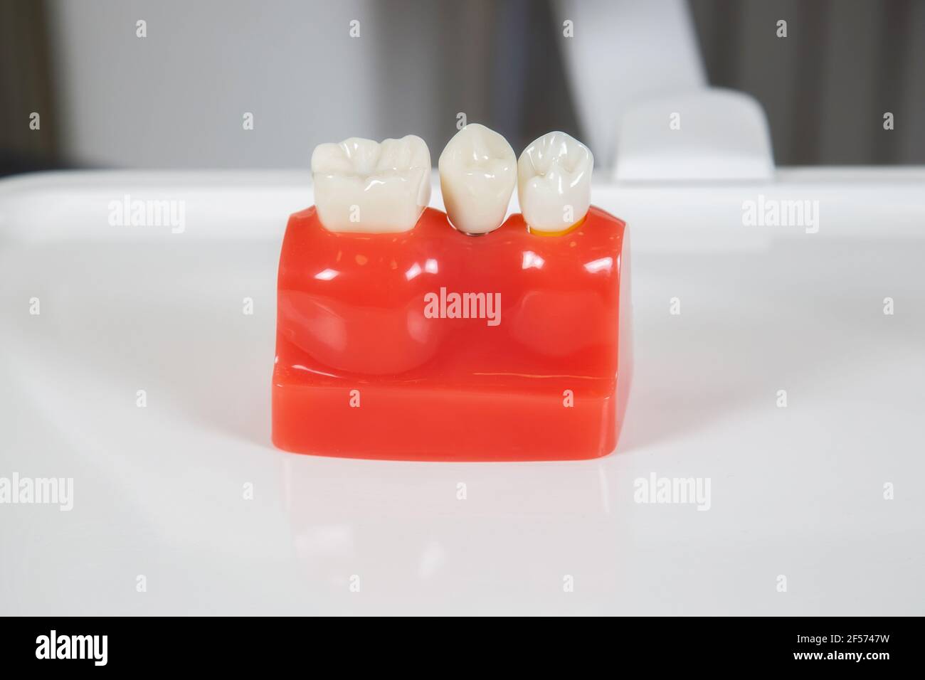 Plastic dental crowns, imitation of a dental prosthesis of a dental ...