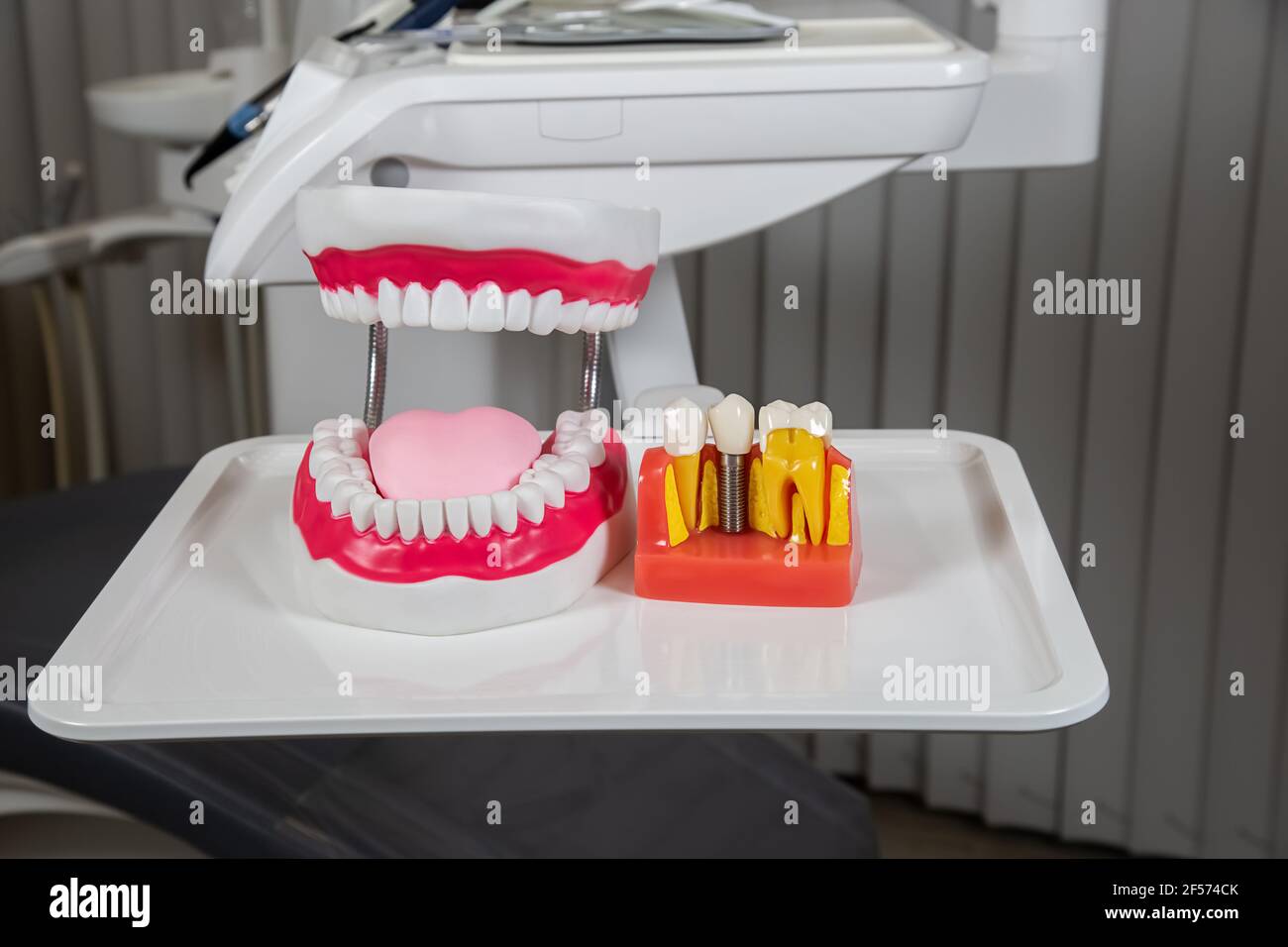 Teeth crowns images hi-res stock photography and images - Alamy