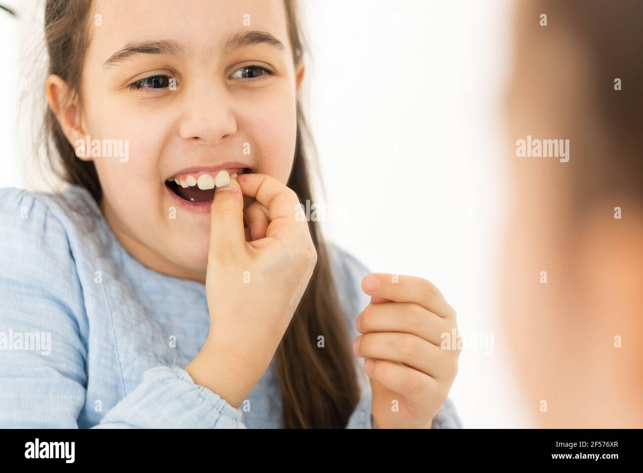 Cute young child holding her tooth which may be loose or aching Stock ...