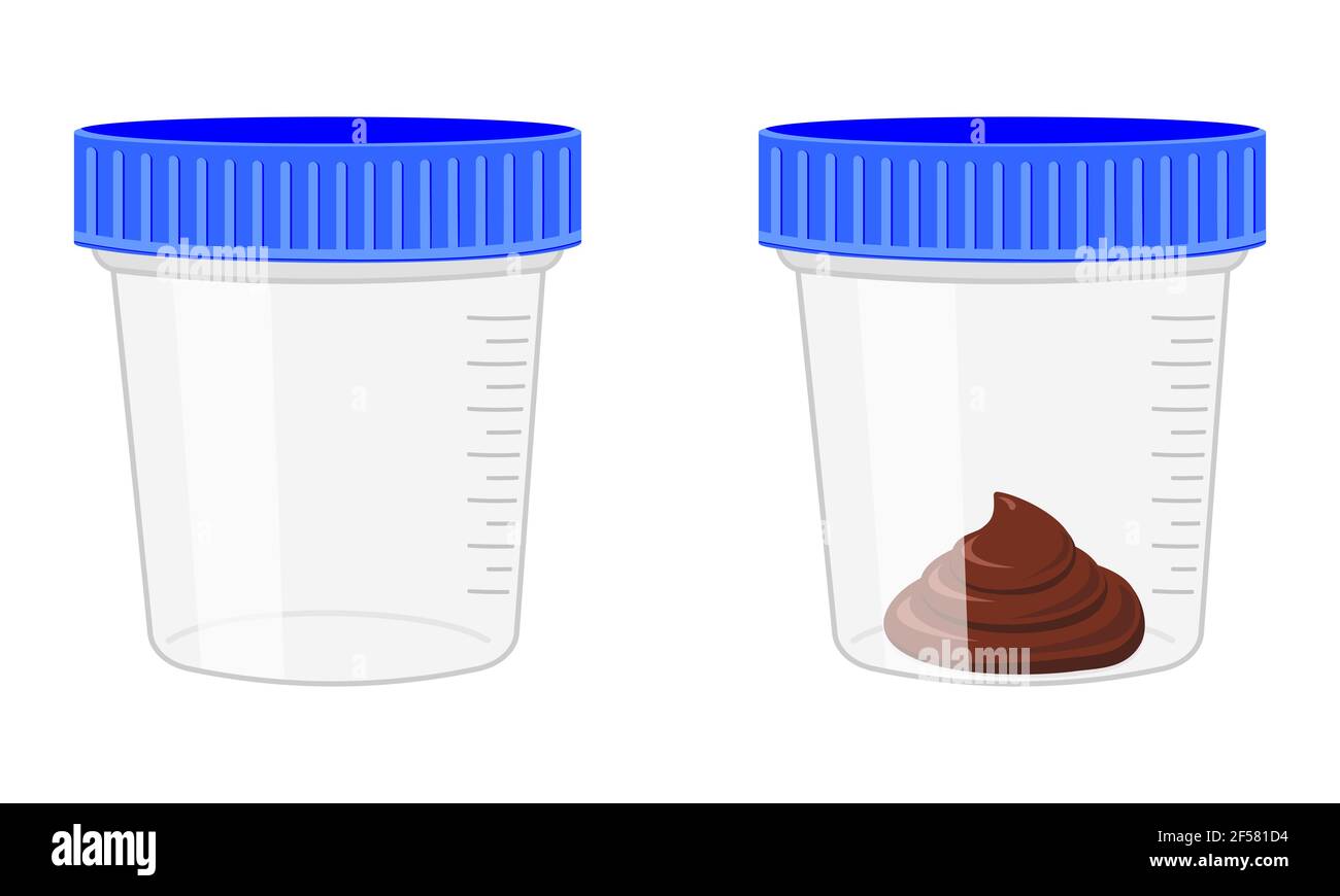 Stool sample, empty and full plastic cups. Poop analysis. Laboratory ...