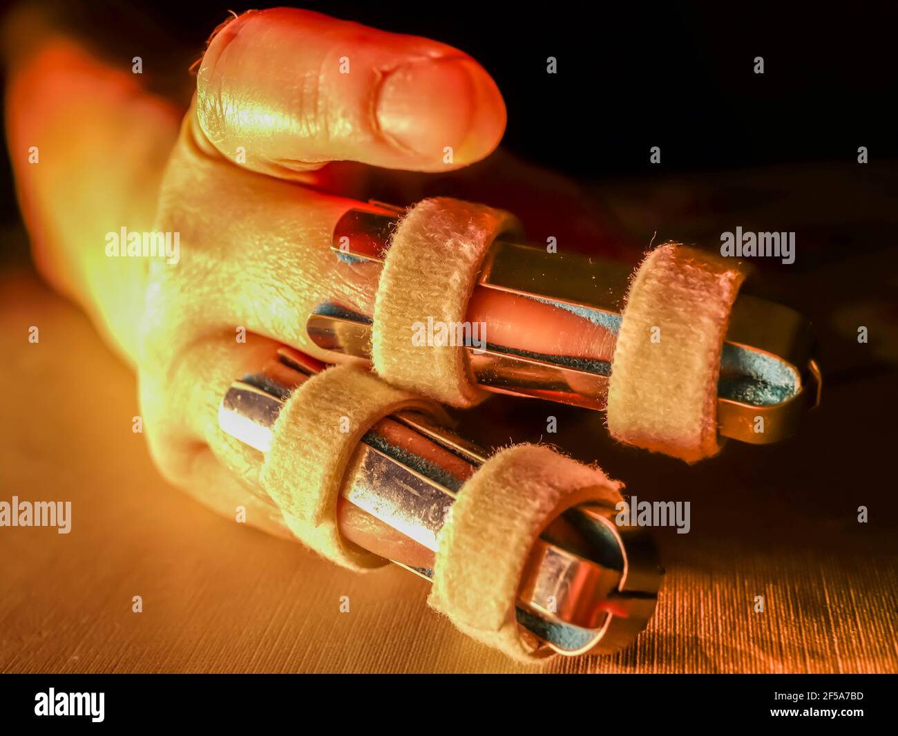 Finger splint hi-res stock photography and images - Alamy