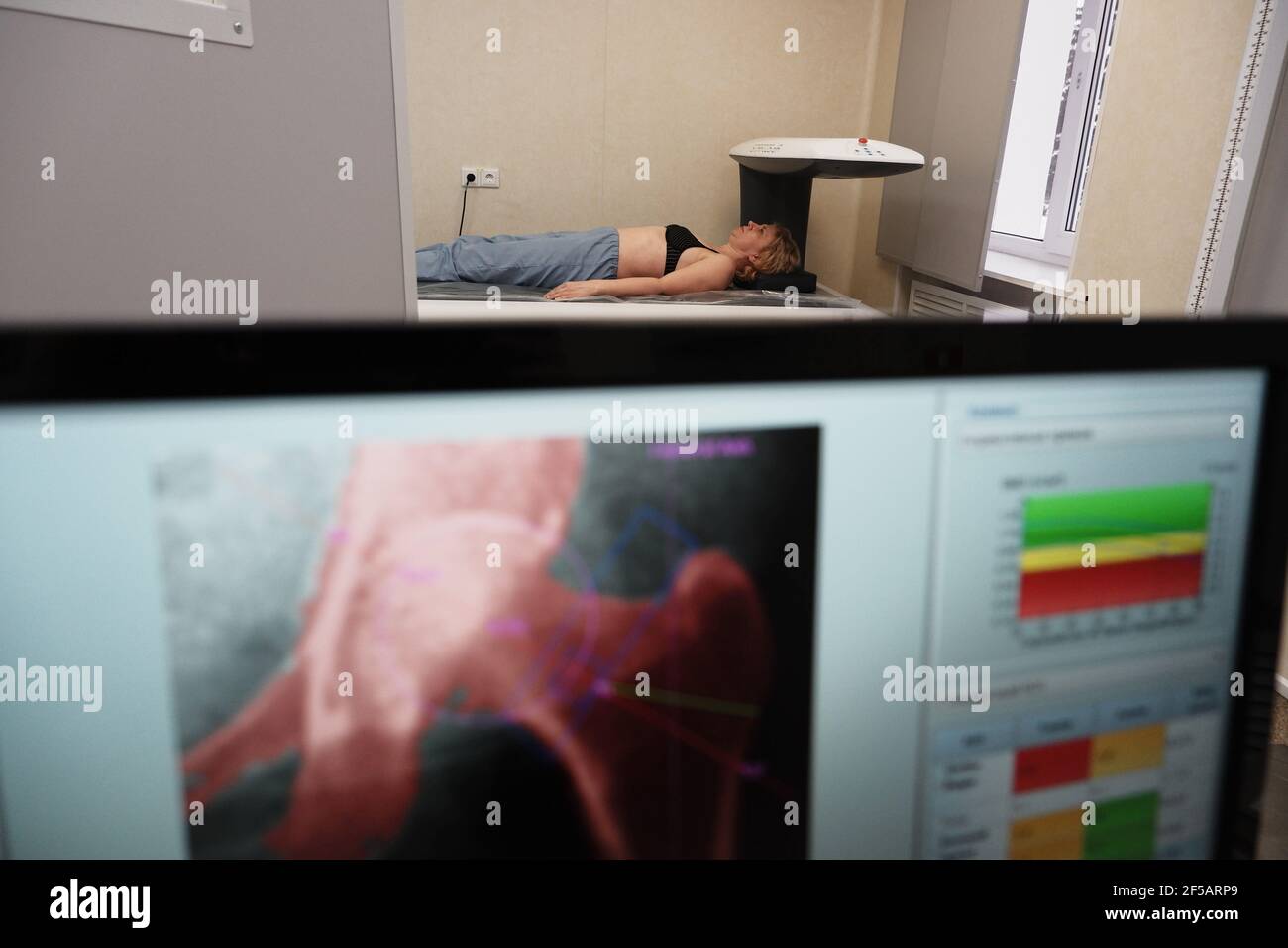 Investigation of the density of human bones using an osteodensitometry ...