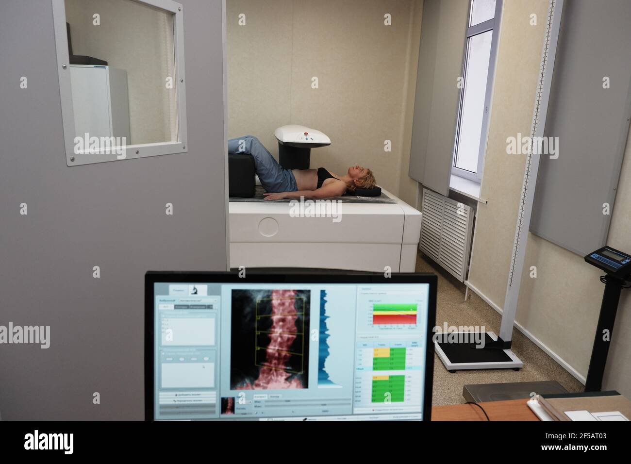 Investigation of the density of human bones using an osteodensitometry ...