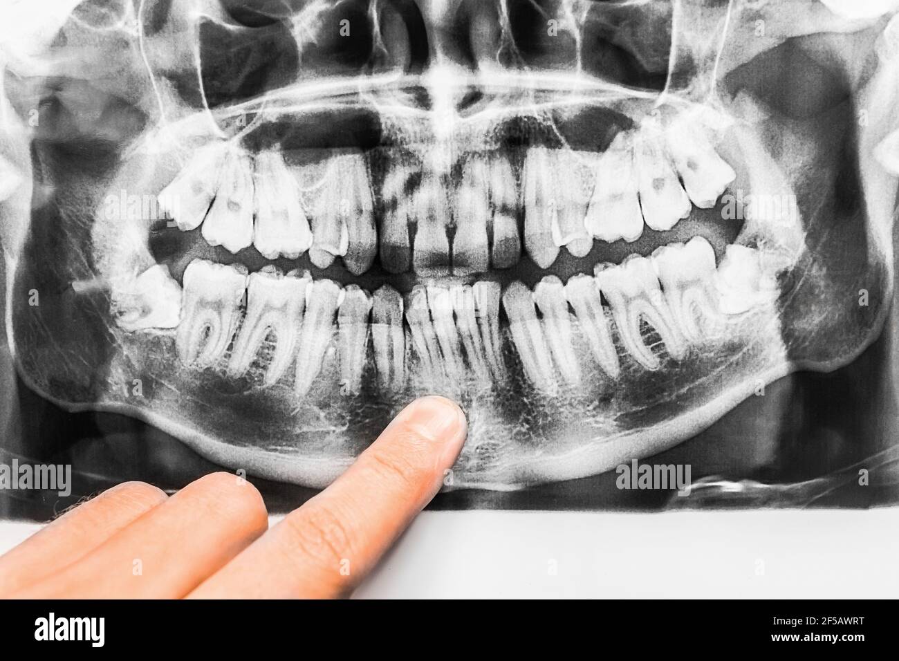 The dentist's hand points the finger at the medical image of the mouth ...