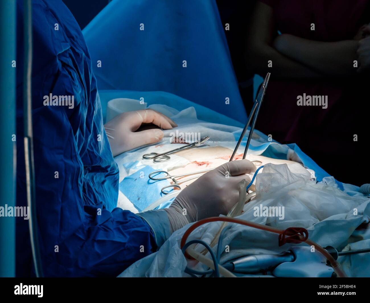 The doctor uses a variety of medical instruments to perform the ...