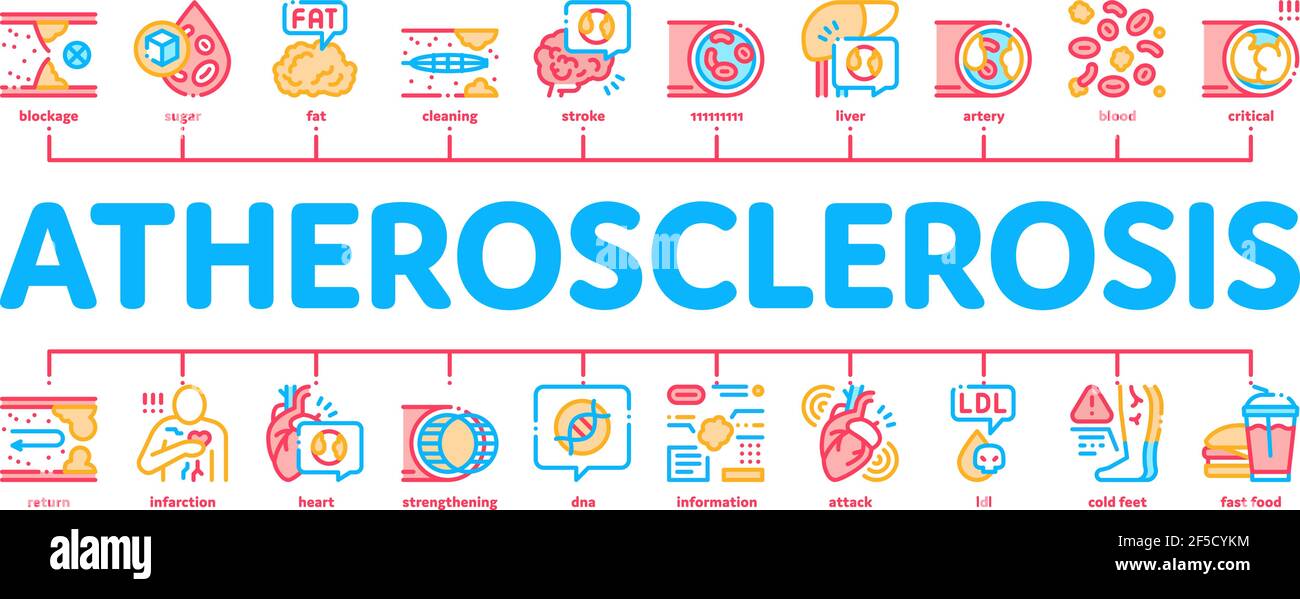 Atherosclerosis Vessel Minimal Infographic Banner Vector Stock Vector ...