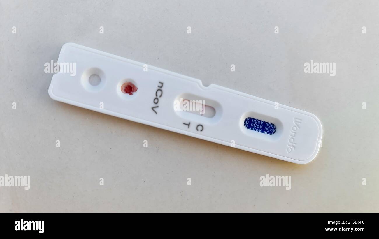 negative SARS-CoV-2 Antigen Rapid Test Stock Photo - Alamy