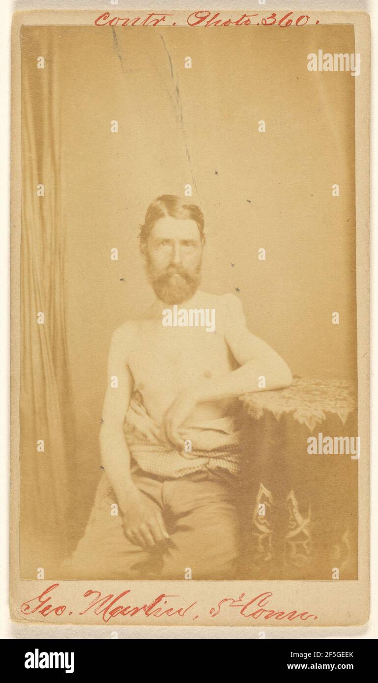 Geo. Martin, 5th Conn. Civil War victim. S. Friedlaender (American ...