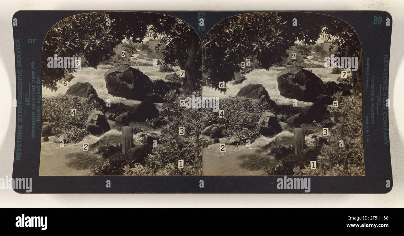 Changing Fixation from 7 to 1 requires 8 1/2 prism diopters of Fusional ...